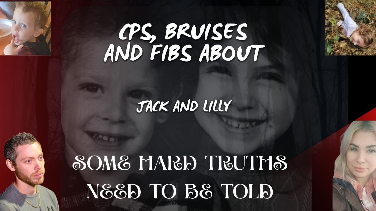 LILLY AND JACK-CPS, BRUISES AND ALL THE FIBS-LET'S CLEAR SOME THINGS UP ...