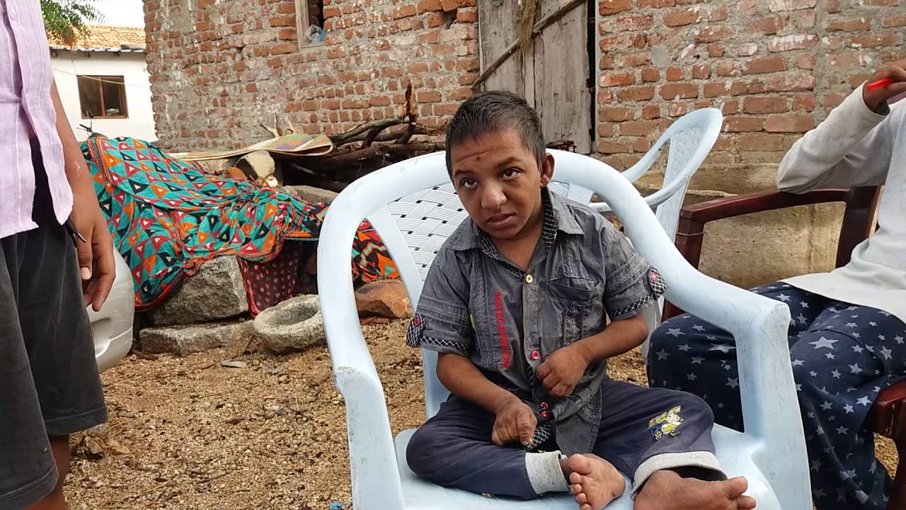 World smallest man in Nizamabad Dist.,Telangana State, India - YouTube