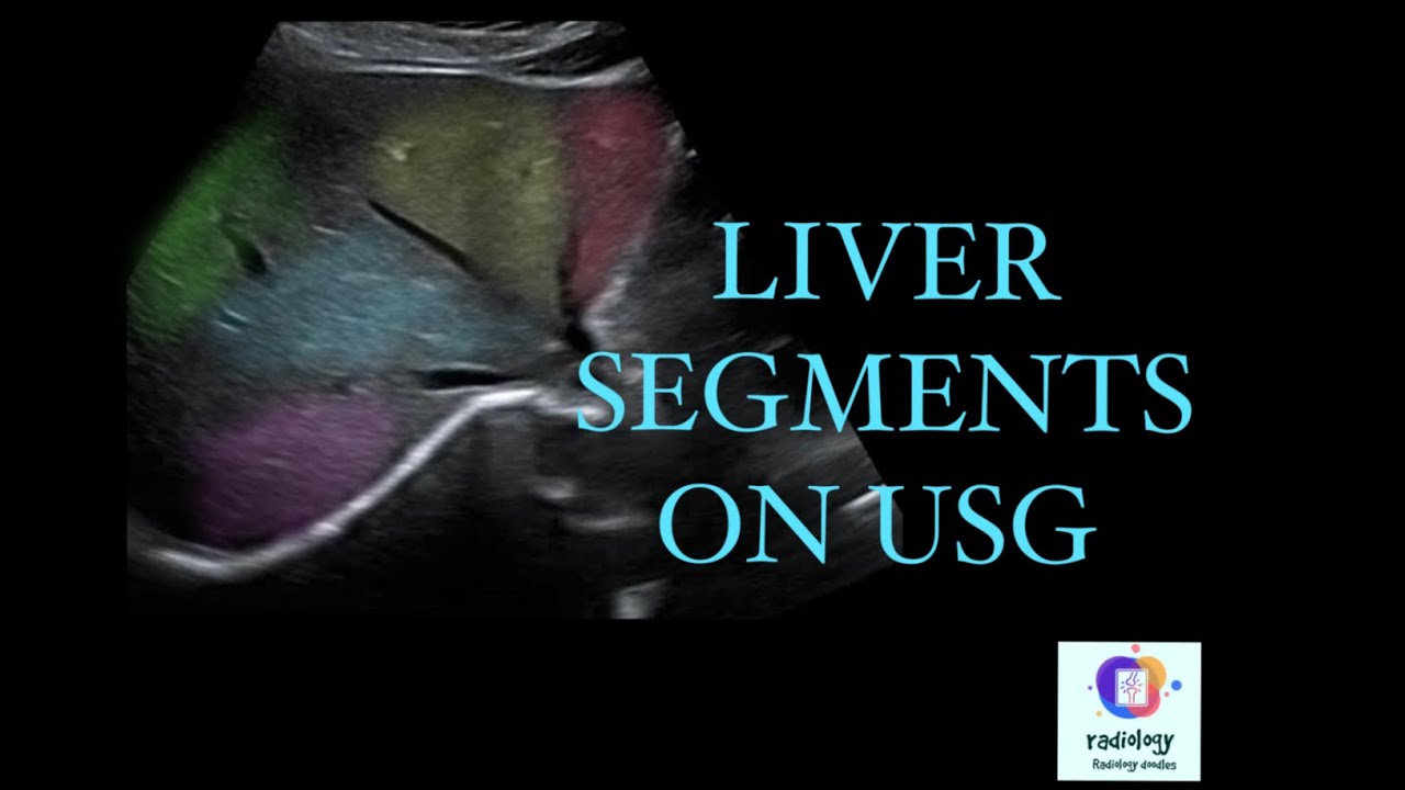 LIVER SEGMENTS ON ULTRASOUNDl Coinaud segmentsl Liver ultrasound procedure for full liver ...