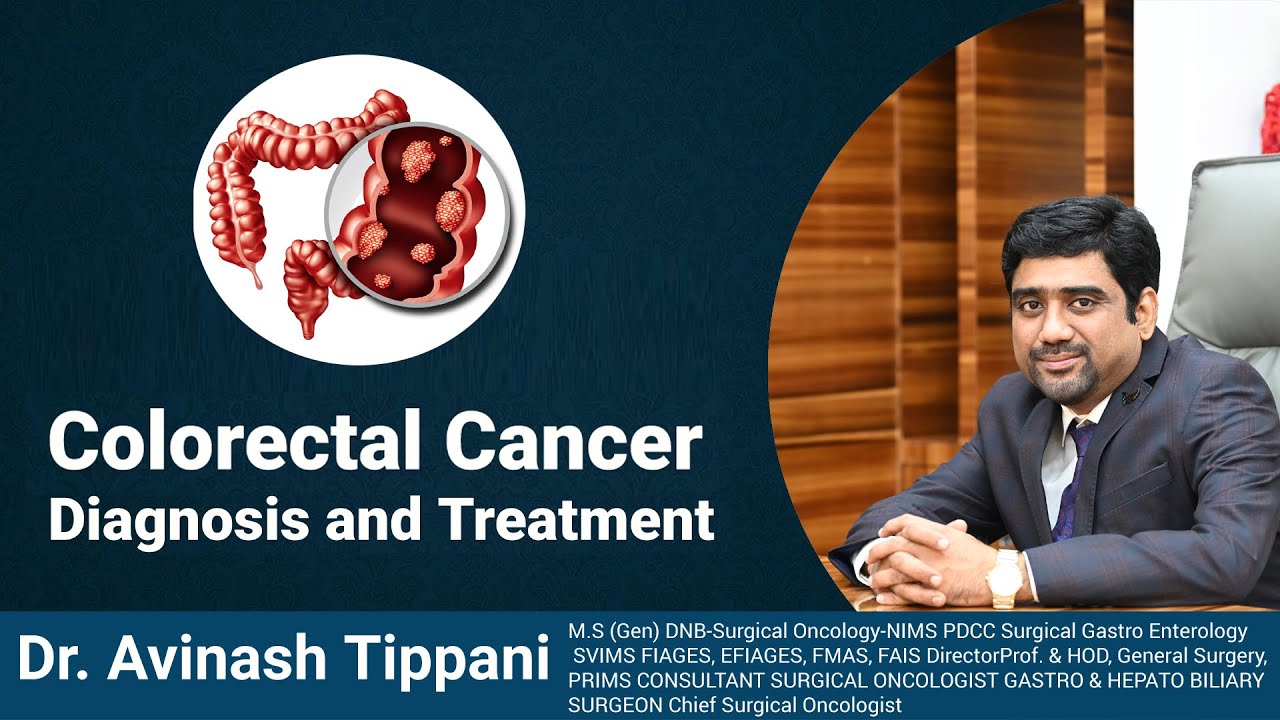 Colorectal Cancer Diagnosis and Treatment | Dr. Avinash Tippani ...