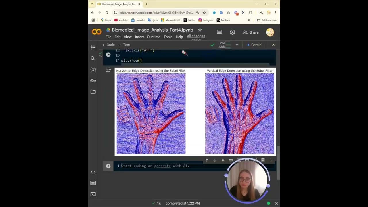 Biomedical Image Analysis Part 4— Feature Detection and Object Labeling in Images - YouTube