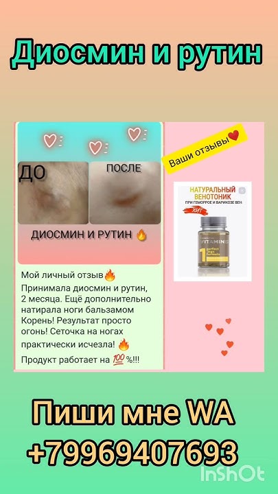 Диосмин и рутин. Инна Сенина. Сибирское здоровье 🌿 - YouTube