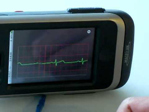 iPhone EGC Sensor/Monitor - YouTube