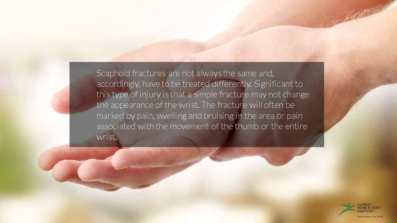 Scaphoid Fractures - Symptoms and Treatment - YouTube