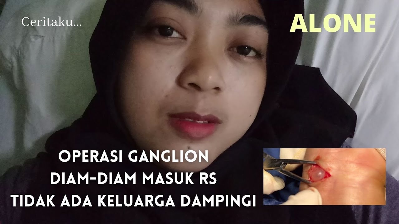 Operasi Kista Ganglion, Ternyata Begini Rasanya - YouTube
