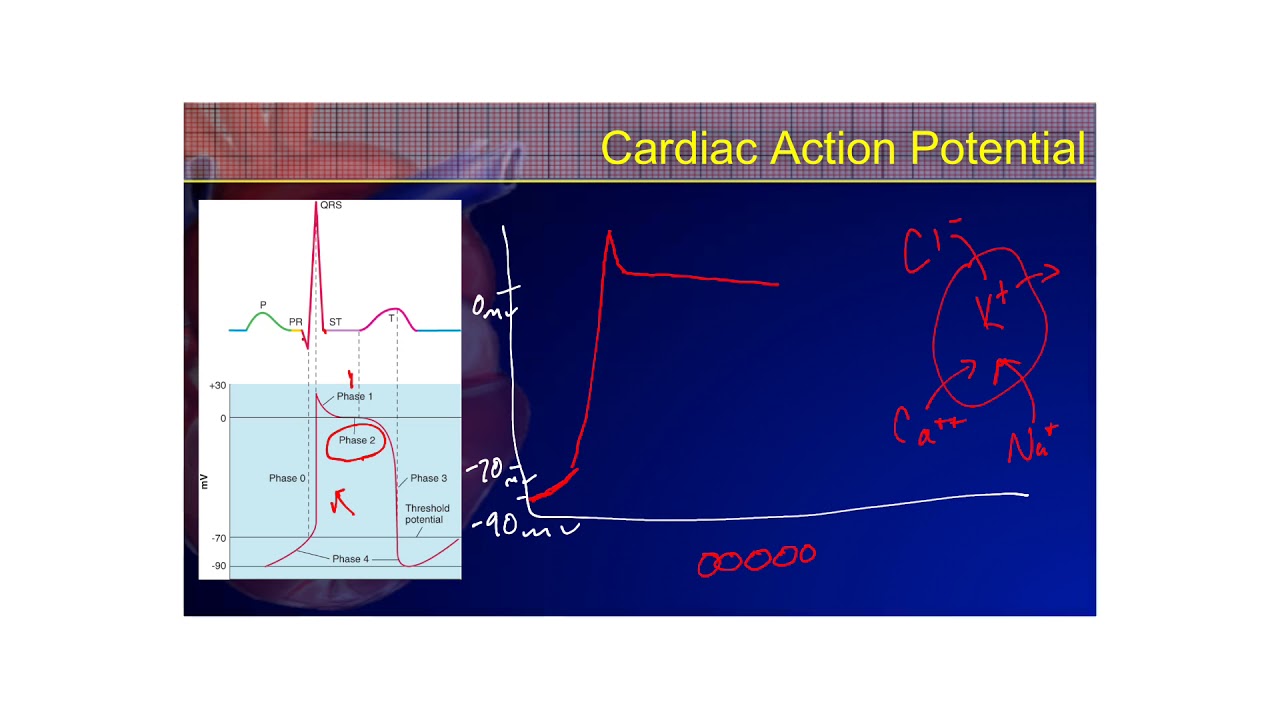 Cardiovascular Emergencies - Lecture 2 - YouTube