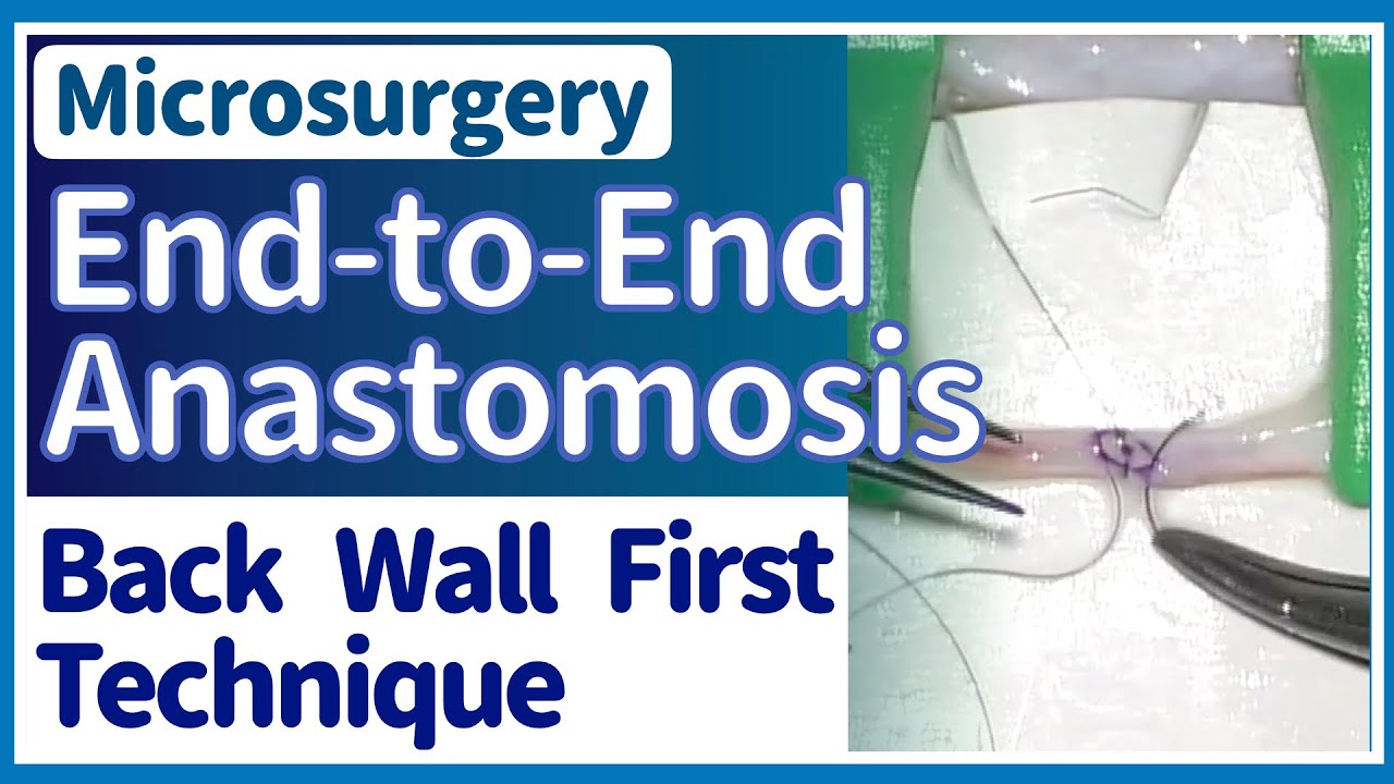 How To Suture - microsurgery end-to-end anastomosis one way up technique - YouTube