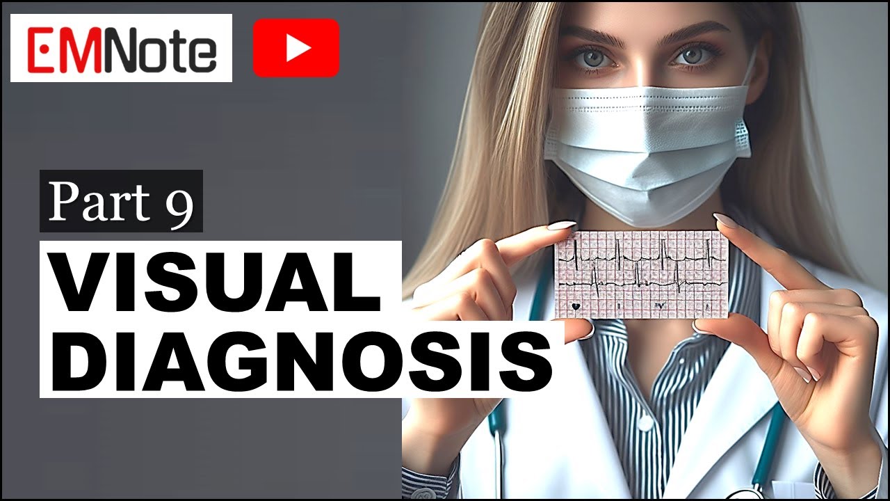 Visual Diagnosis Part 9 - YouTube