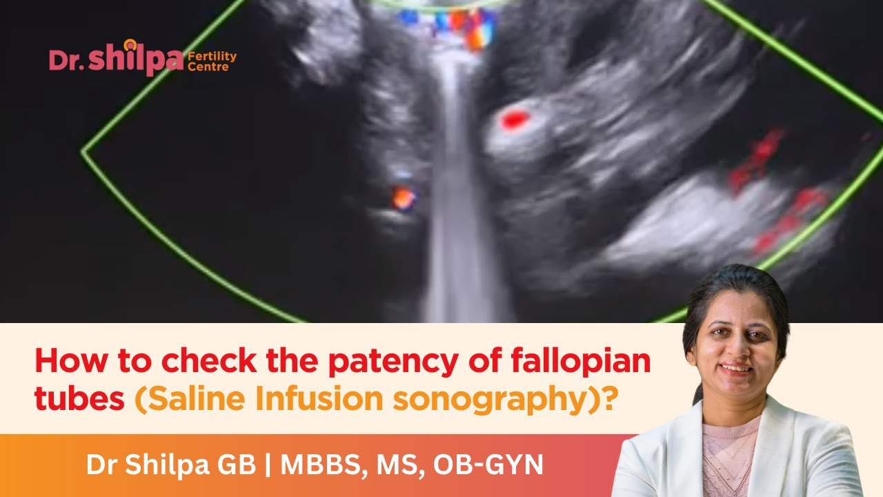 How to check the patency of fallopian tubes (saline Infusion sonography ...