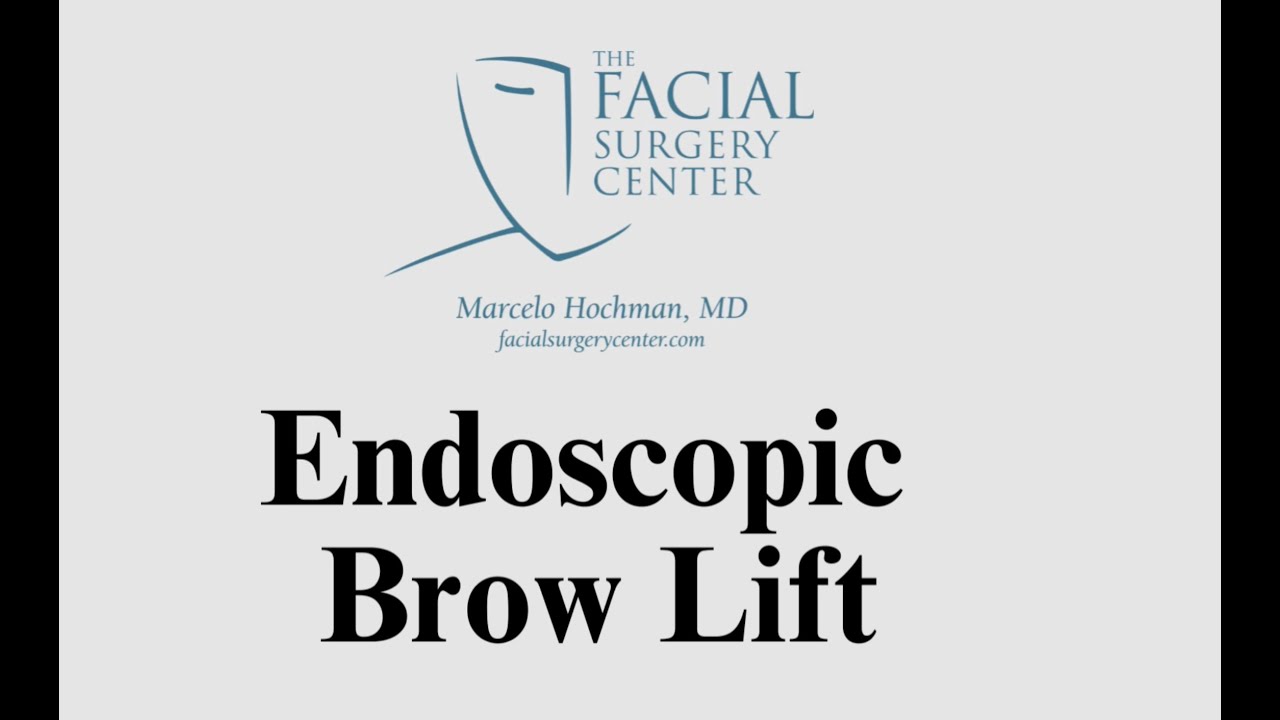 Endoscopic Brow Lift - Dr. Marcelo Hochman - YouTube
