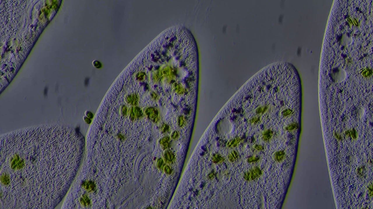 Paramecium, 400X, BF+DF+PL - YouTube