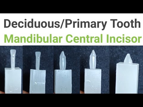 Carving of Primary Mandibular Central Incisor || Carving of Deciduous ...