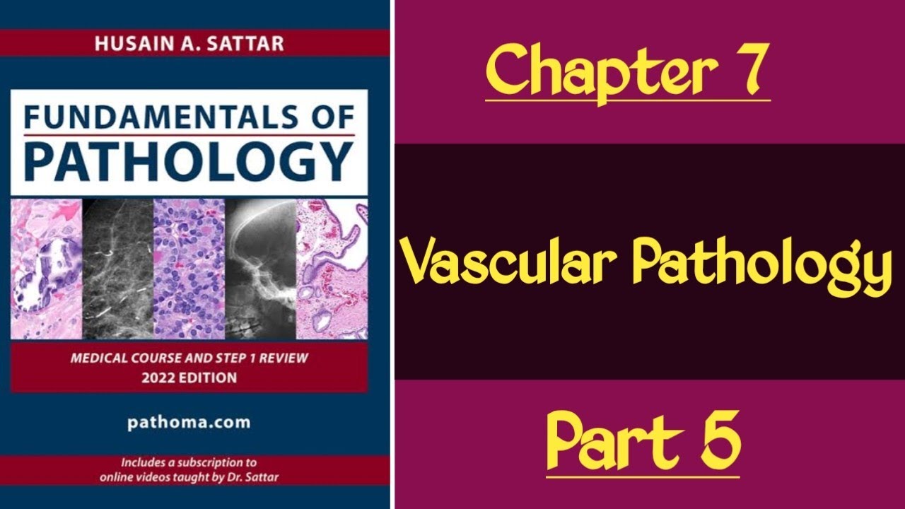 Pathoma Lectures || Chapter 7 Vascular Pathology (Part 5) - YouTube
