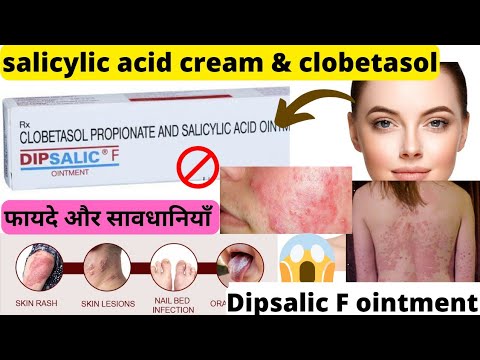 Dipsalic f ointment uses in hindi|Dipsalic f ointment|Clobetasol ...