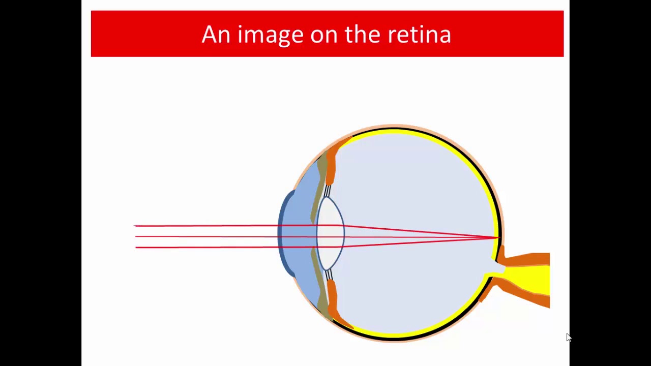 GCSE PHYSICS - WAVES LIGHT - LESSON 16 - imaging the eye correction of ...