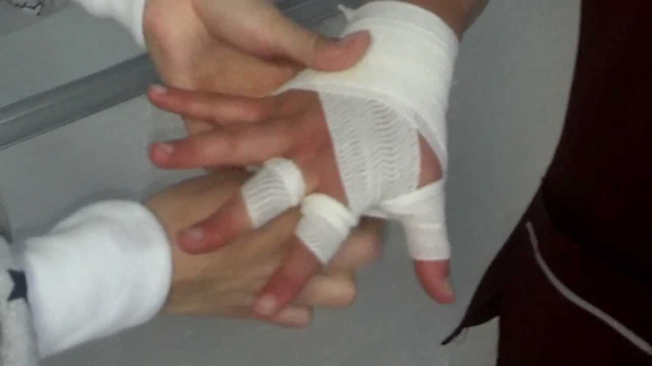 Vendaje de mano flexión - YouTube