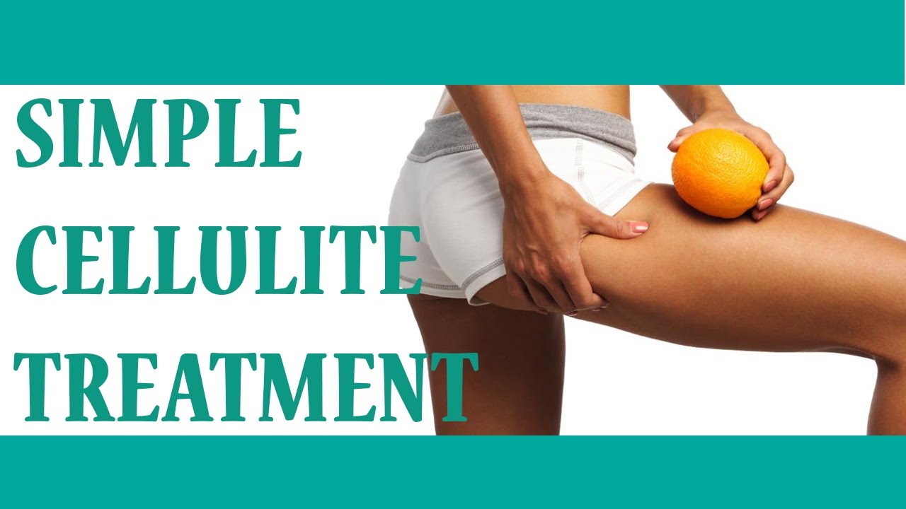 The Only Cellulite Treatment That Works - YouTube
