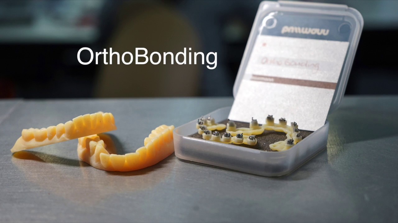 OrthoBonding - YouTube