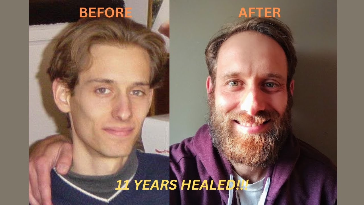 Joshua's Healing Testimony - YouTube
