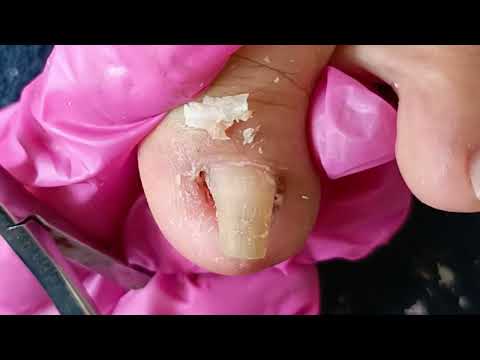 Grabe ang kapal ng dry skin niya😯 - YouTube