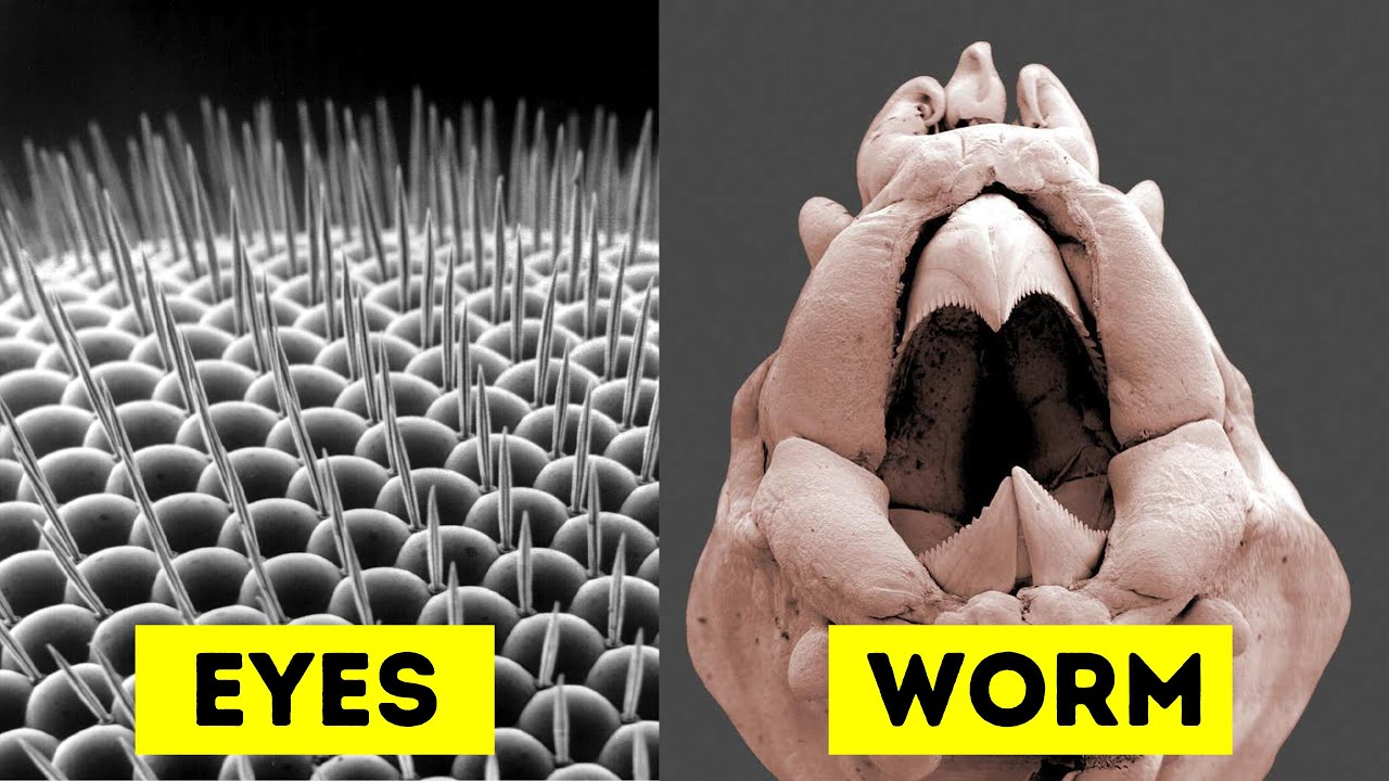 Images Under Electron Microscope