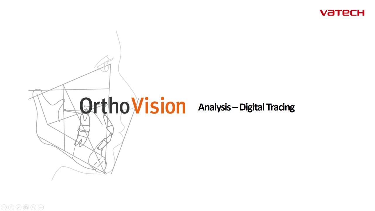 [simple tutorial 02] Analysis Digital Tracing - YouTube