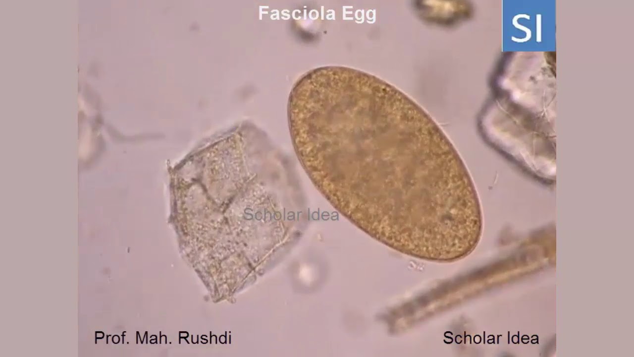 Fasciola egg - YouTube