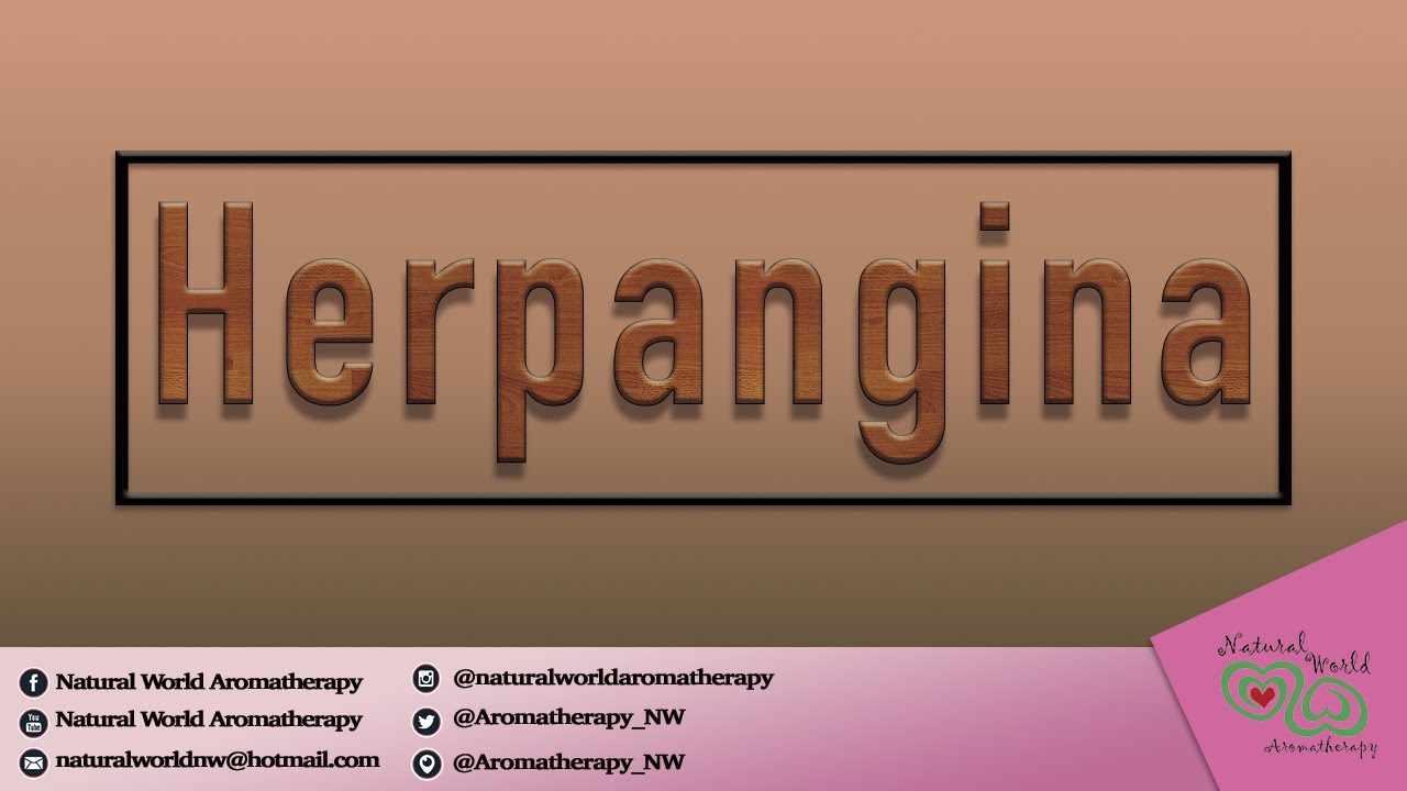 Herpangina E Aromaterapia Youtube