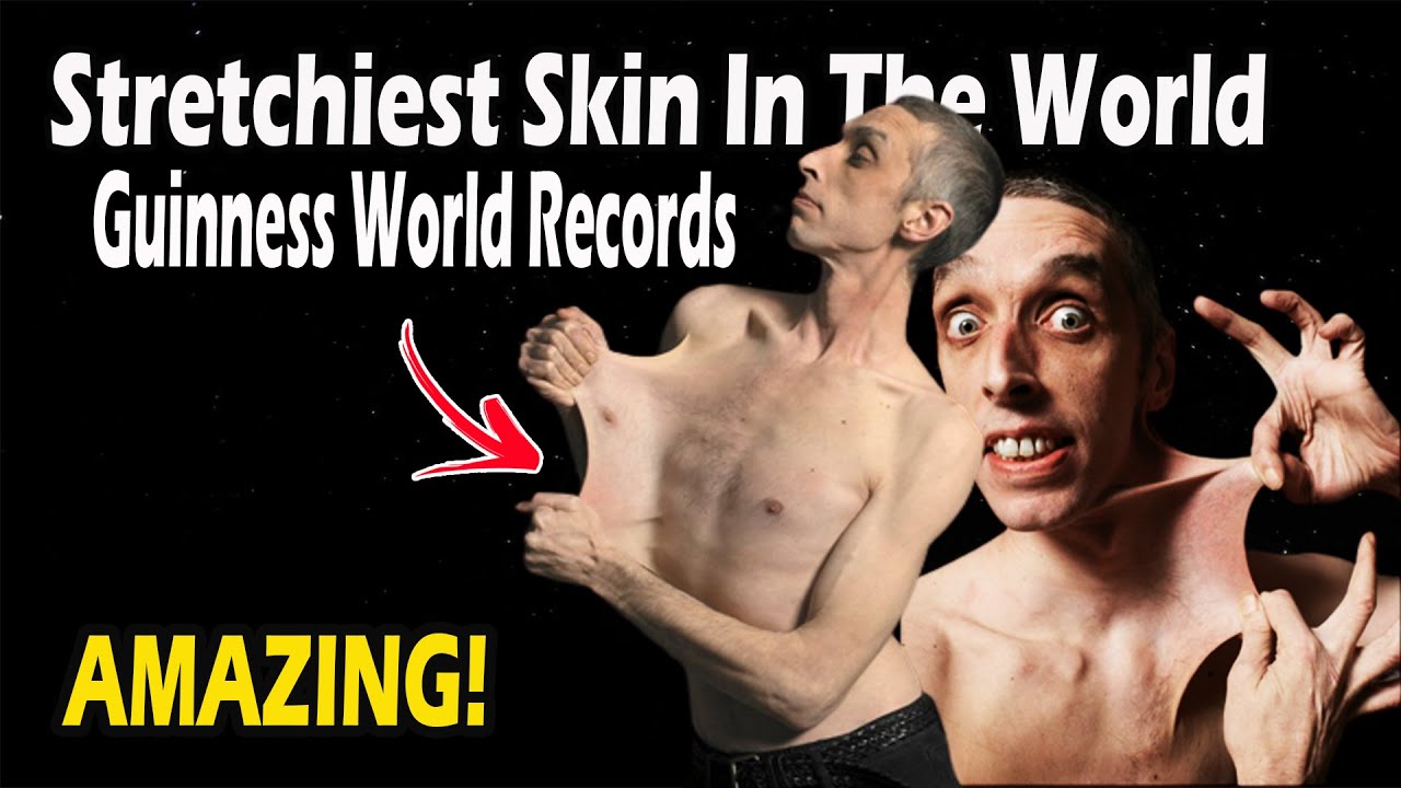 LALAKI NA MAY NAKAKAMANGHANG KAKAYAHAN/Stretchiest Skin In The World ...