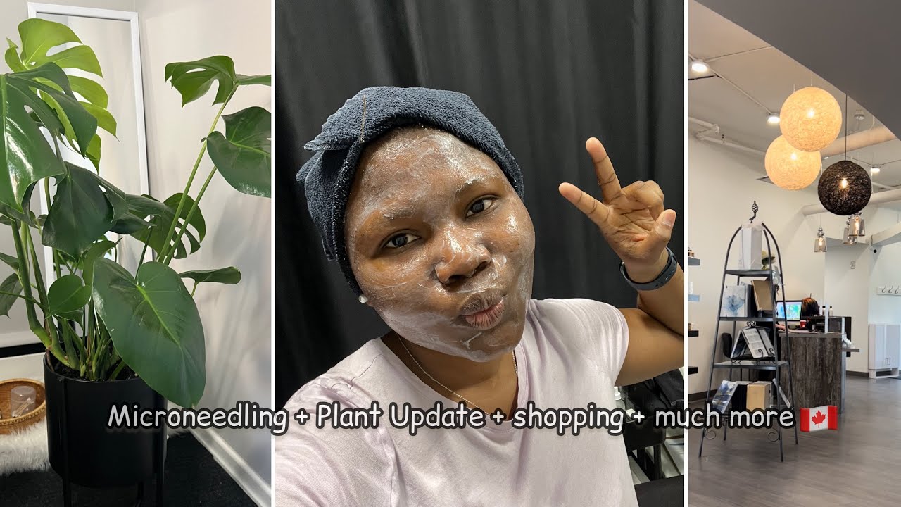 VLOG: I had a micro needling procedure😊| Plant Update🪴|Shopping🛍 ...
