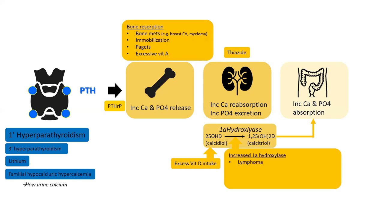 Hypercalcemia - Diagnosis and Management - YouTube