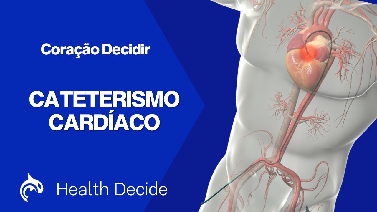 Cateterismo Cardíaco - Português - YouTube