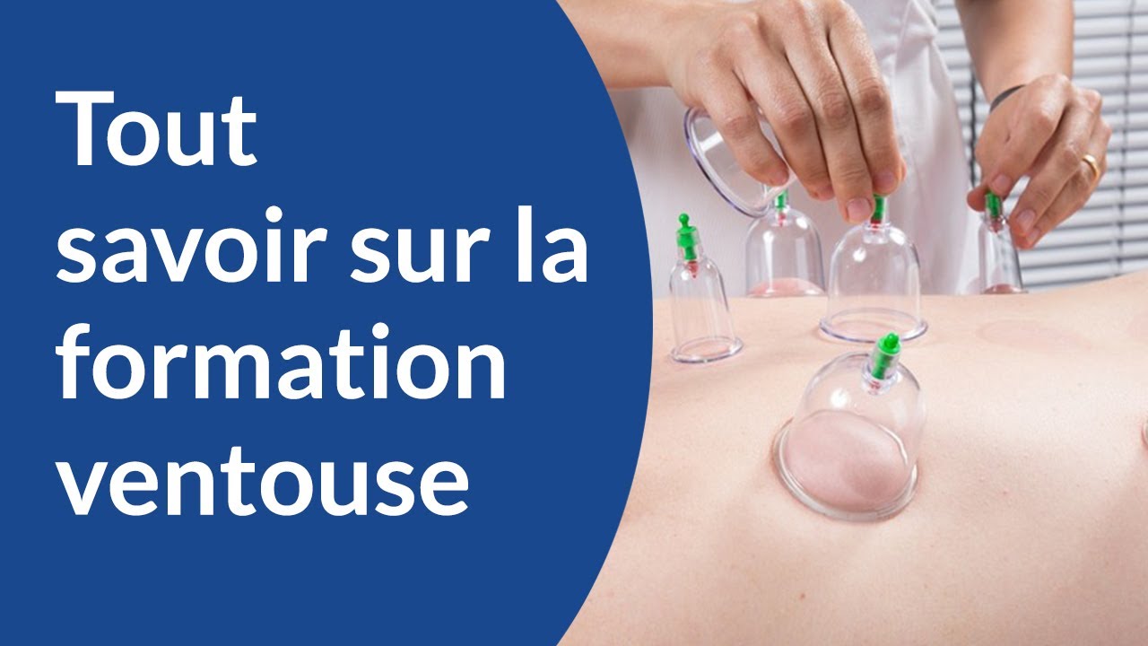Ventouses ou cupping en ostéopathie : la formation du CFPCO avec notre expert, Bertrand Courtot ...