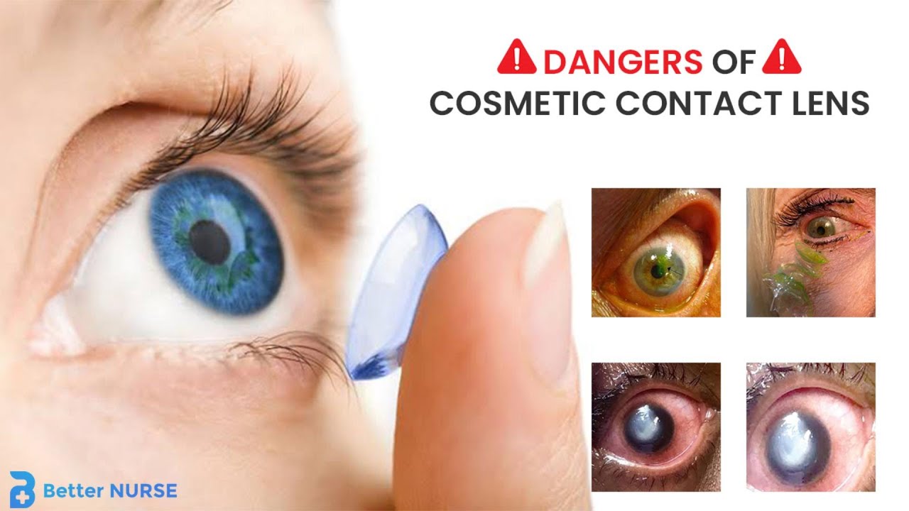DANGERS OF COSMETIC CONTACT LENS || Better NURSE - YouTube