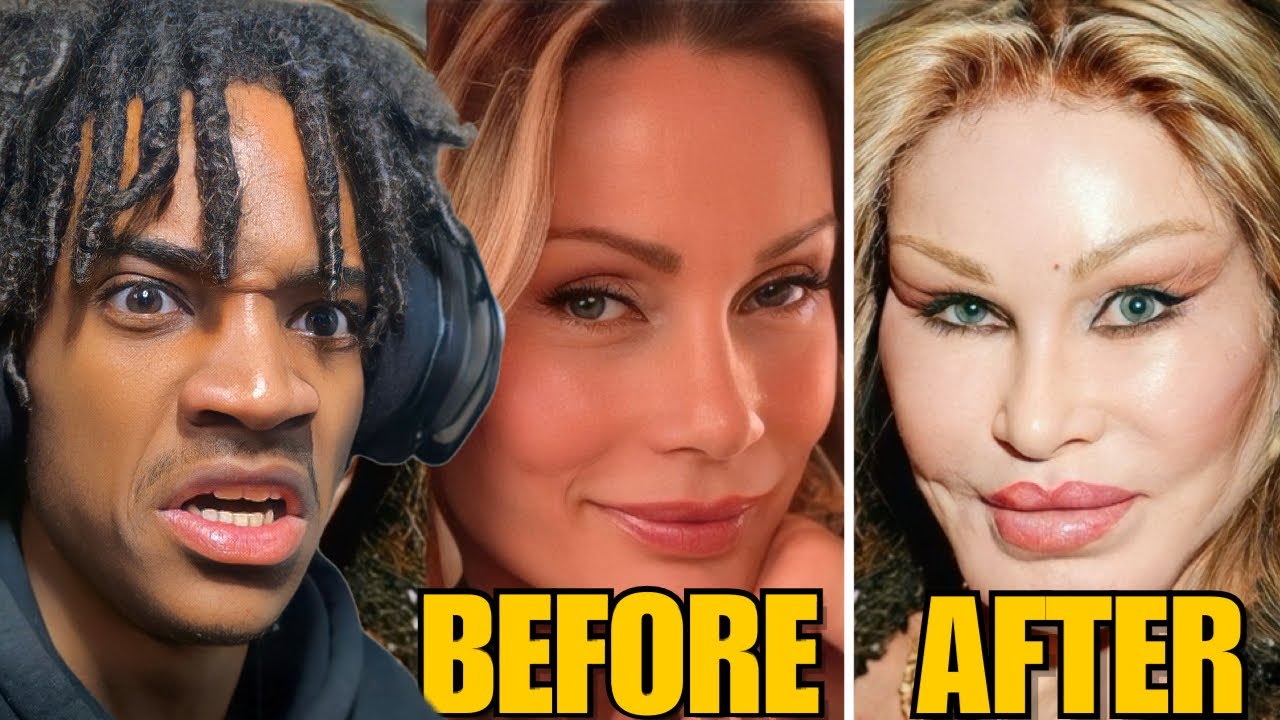 10 Plastic Surgeries That Went HORRIBLY Wrong... - YouTube