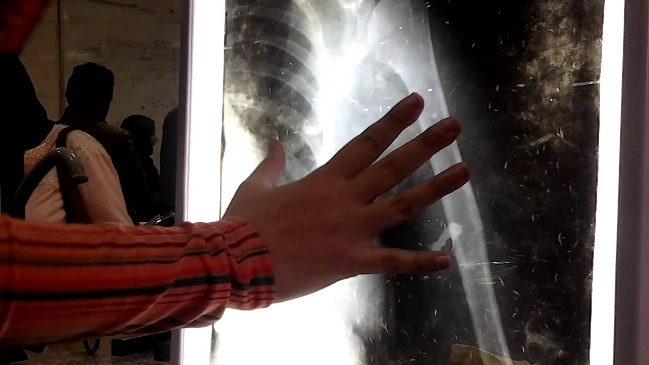 Practical Forensic - X-ray - Part 1 - YouTube