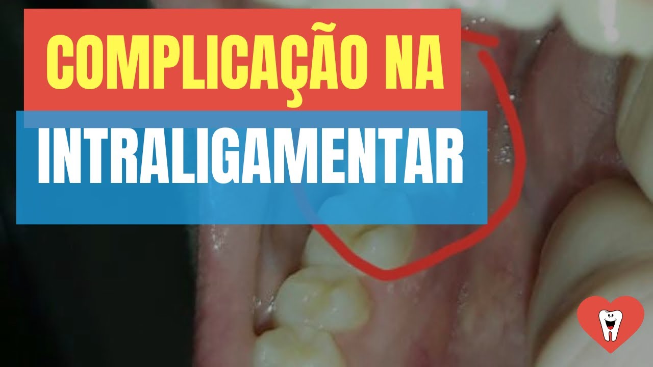 SAIBA COMO EVITAR ESSA COMPLICAÇÃO SÉRIA ANTES DA SUA PRÓXIMA ANESTESIA ...