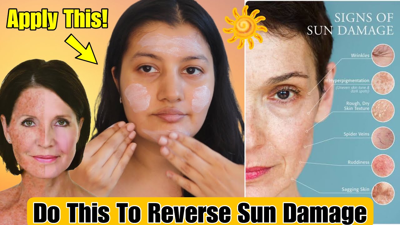 How To Reverse Sun Damage? Tanning, Dark Spots, Ageing, Pigmentation ...