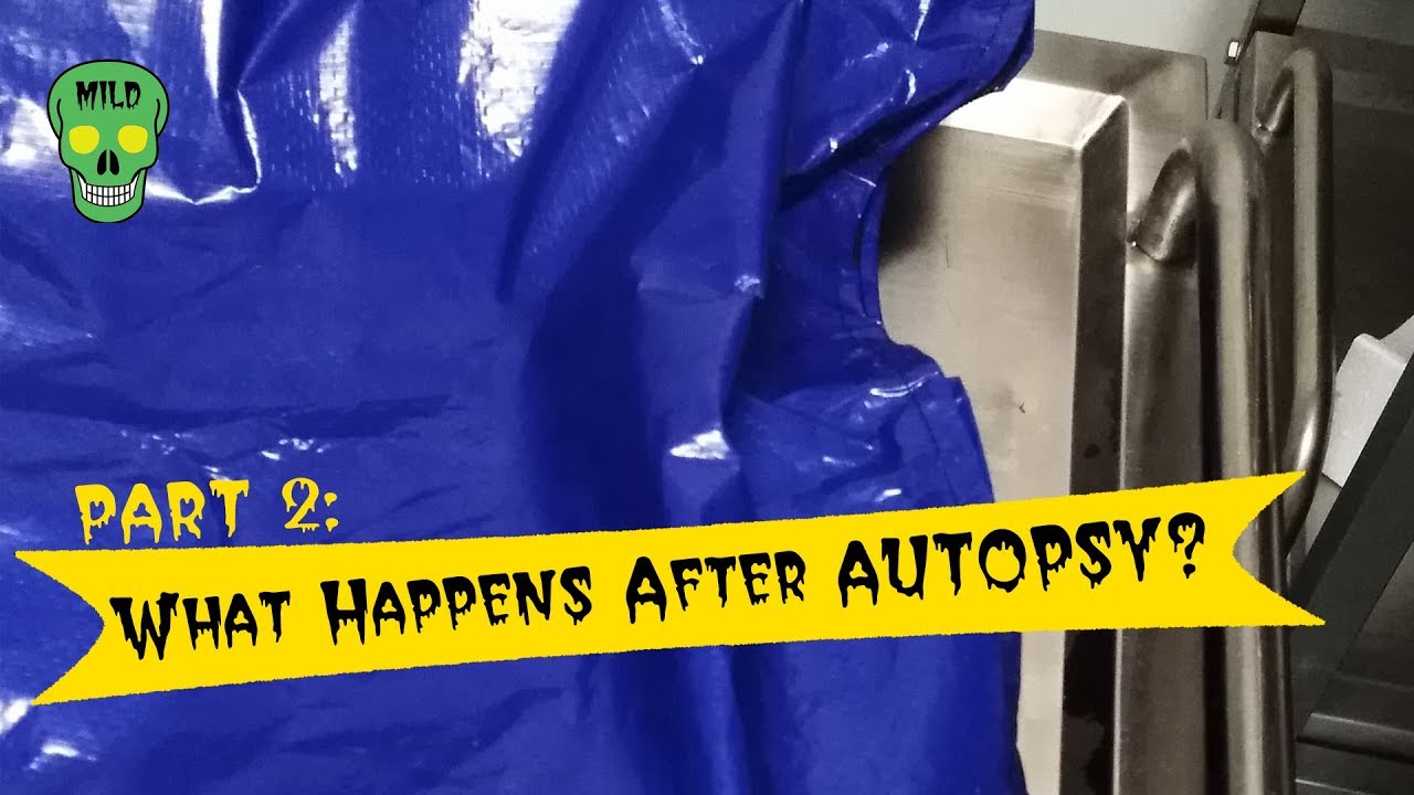 Part 2: What happens after an Autopsy? - YouTube