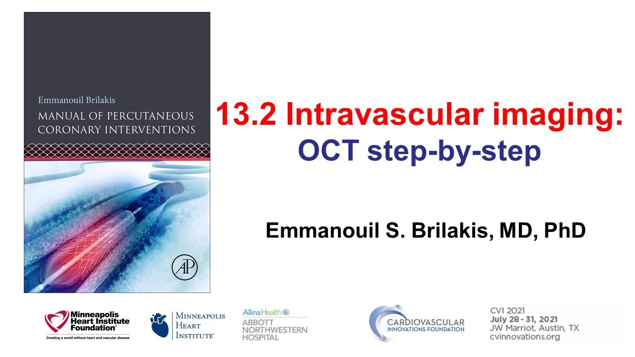 13.2 Manual of PCI - OCT step-by-step - YouTube