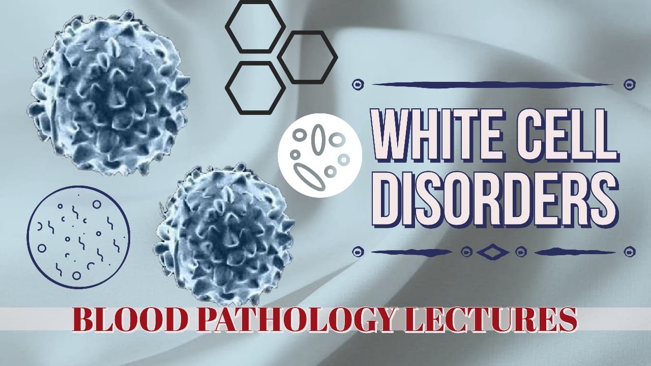 WHITE CELLS DISORDERS lecture 2 INFECTIOUS MONONUCLEOSIS and ...