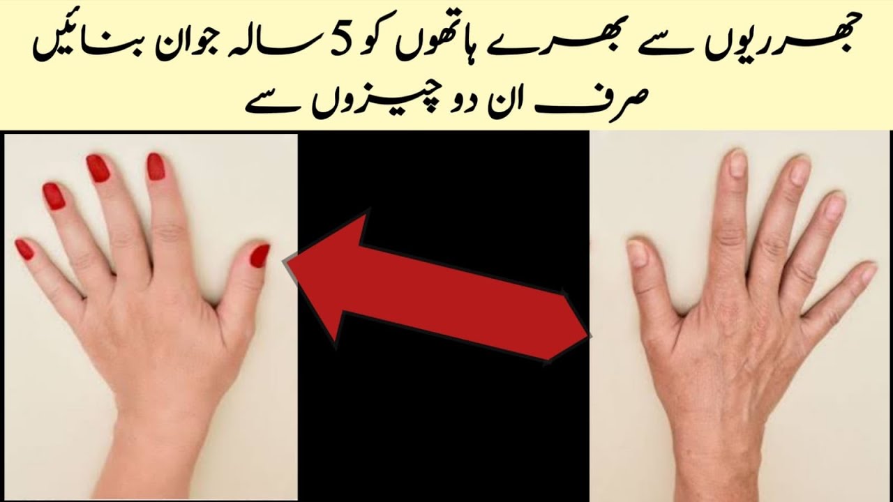How To Make Your Hands Look 5 Years Younger - Wrinkle Free Soft Smooth ...