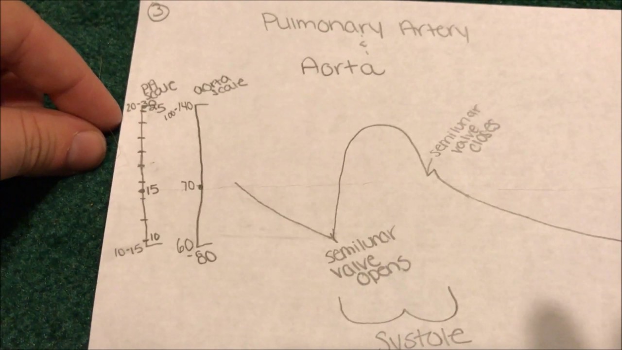 Hemodynamic Waveforms - YouTube