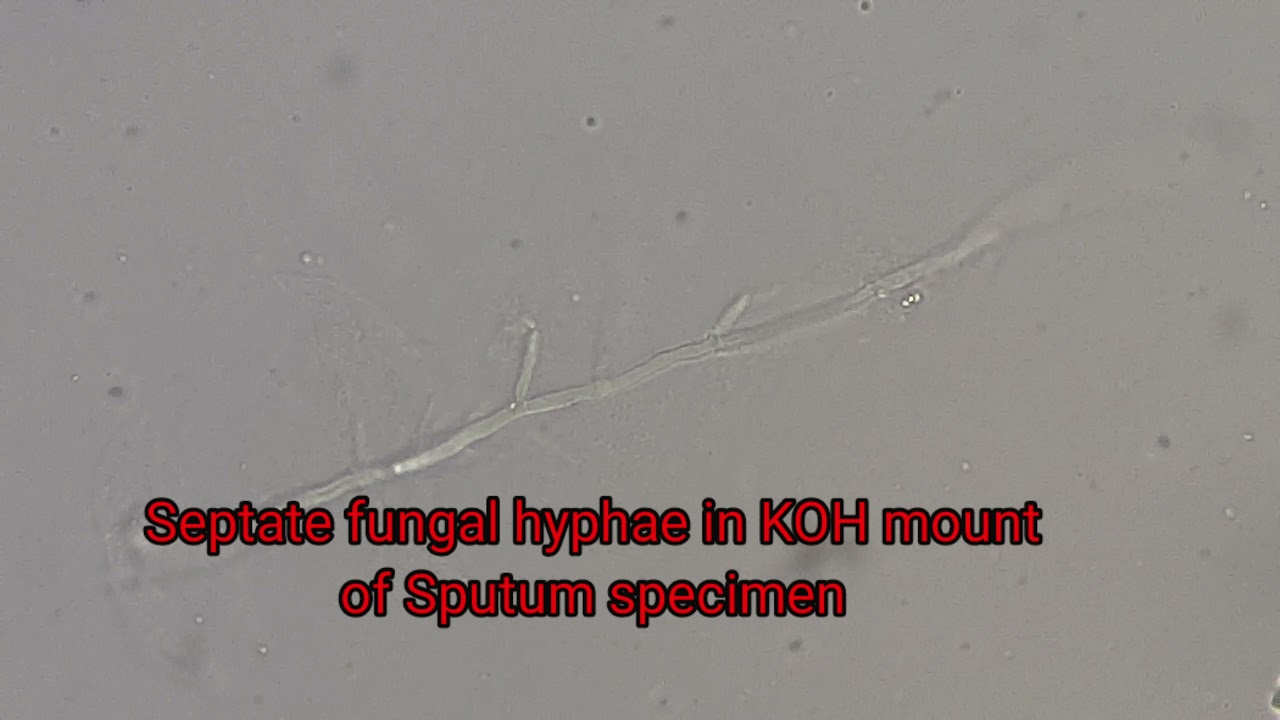 Penicillium Septate Hyphae