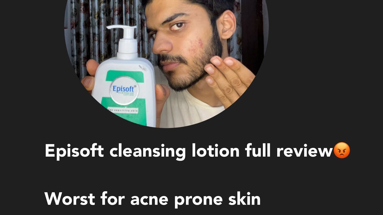 Episoft cleansing lotion review for acne prone skin|Oily skin|Acne ...
