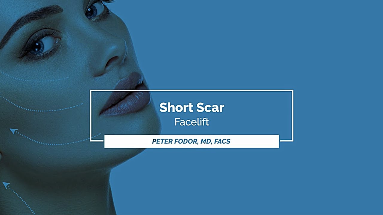 Understanding the Power of a Short Scar Facelift - YouTube