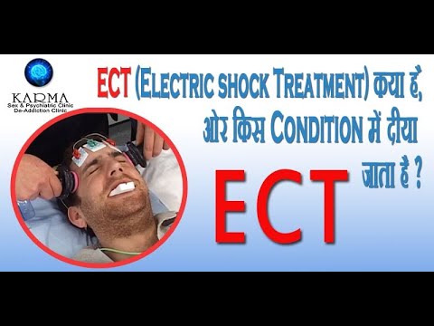 ECT "ELECTROCONVULSIVE THERAPY" -"shock treatment" - YouTube