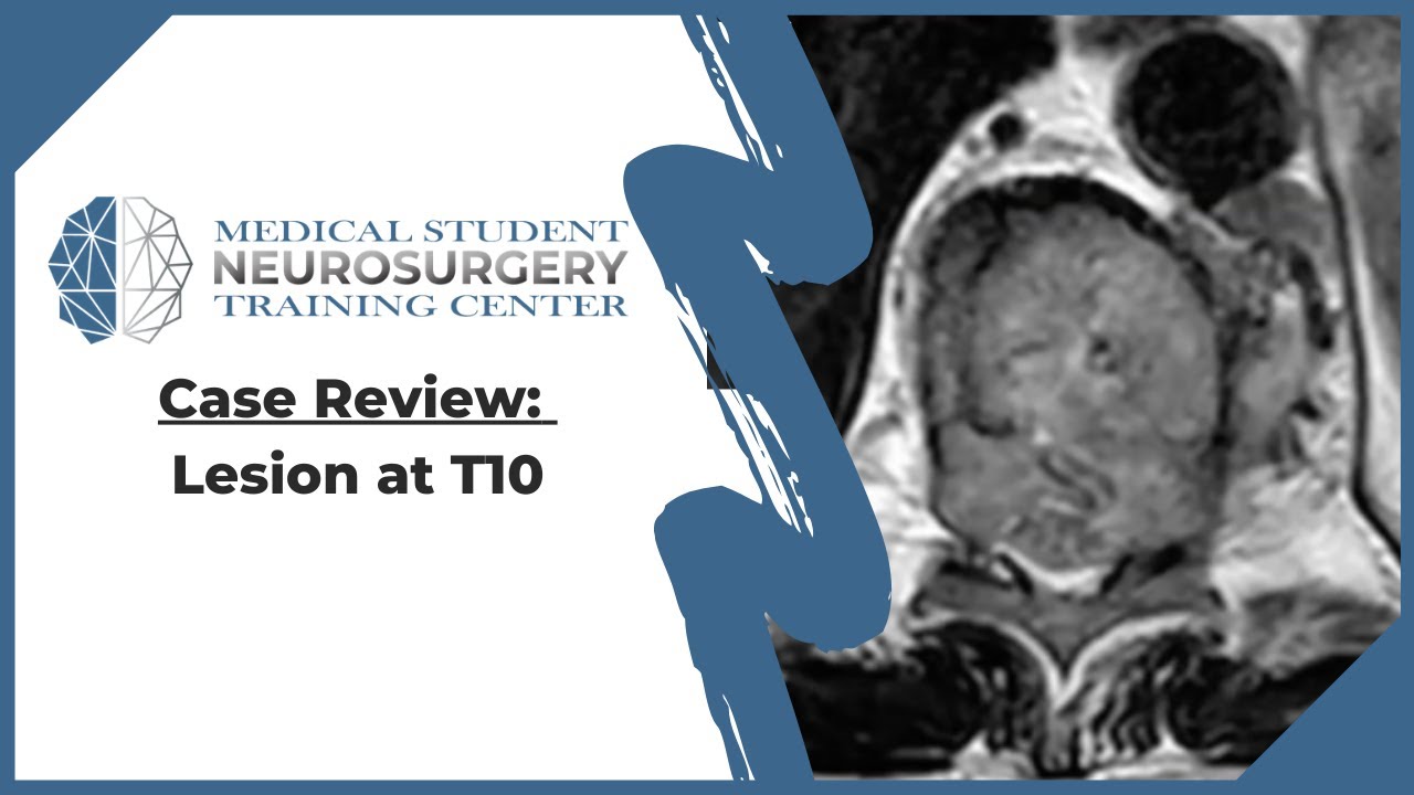 Case Review: Lesion at T10 - YouTube
