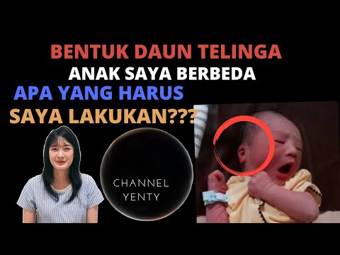 Bentuk Kedua Daun Telinga Anak Saya Berbeda Saya Harus Bagaimana ? Bentuk Daun Telinga Asimetris