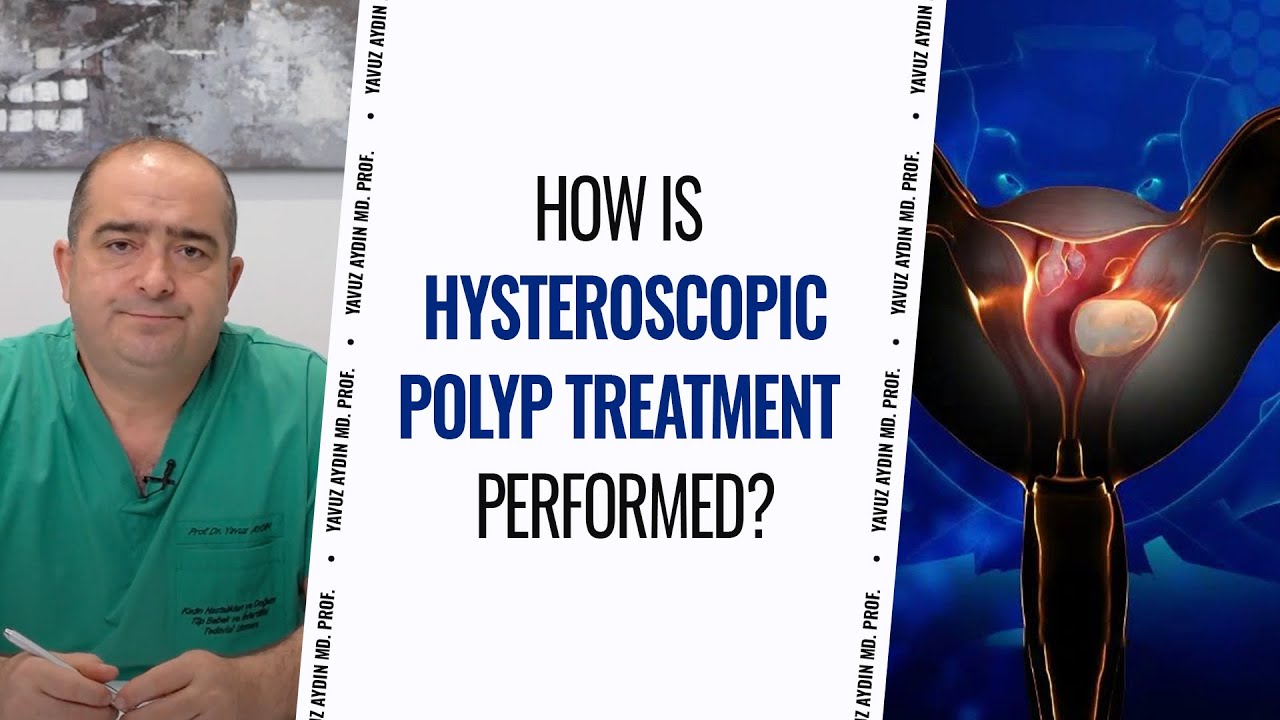 How is Hysteroscopic Polyp Treatment Performed? - Prof. Dr. Yavuz Aydın ...